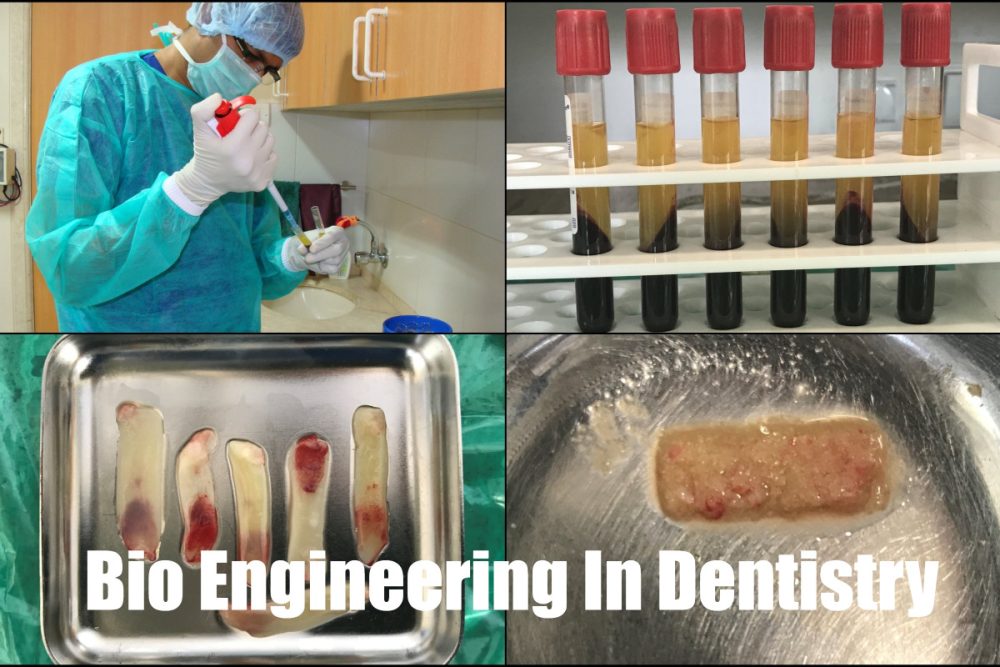Bio-Engineering In Dentistry - Dr. Ashish Shah